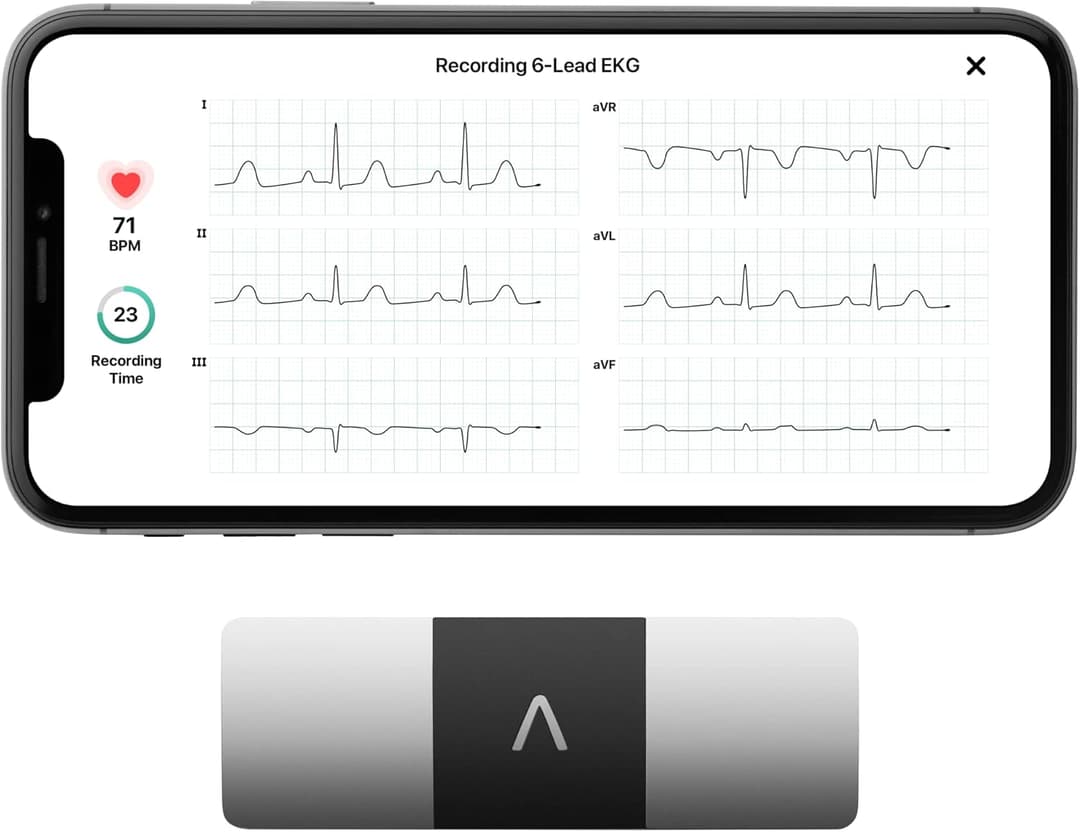 ECG Monitors UK, 2026 — Best Portable, Home & Clinical ECG Monitors ...